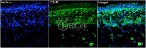 Icam2 Cd102 Antibody Bicell Scientific®