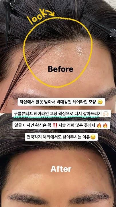 남자 올림머리 전 이것부터 헤어라인 교정왁싱 Youtube