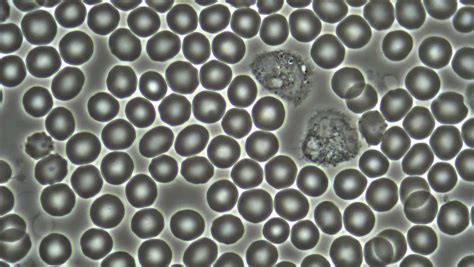 Eritrocitos Normal 7 Horas 2 Cursos De Medicina Natural