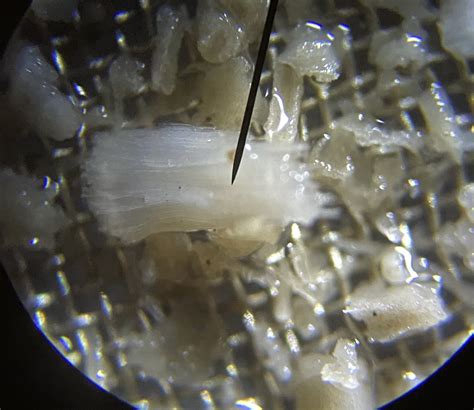 Microfossils Fossil Id The Fossil Forum Microfossils Fossil Id The Fossil Forum