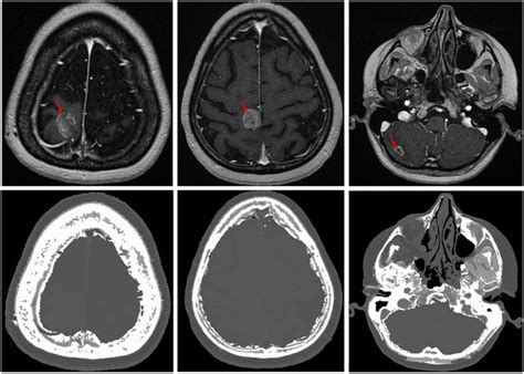 Magnetic Resonance Slices Upper Row And Corresponding Synthetic‐ct