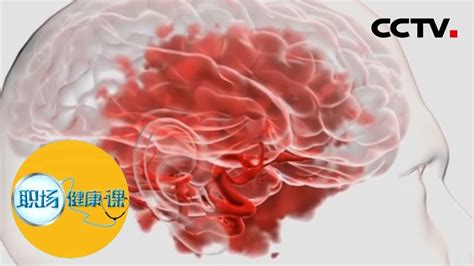 《职场健康课》 冬季如何预防脑出血 20190108 Cctv财经 Youtube