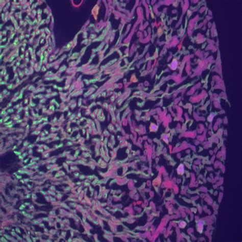 Image Deconvolution 101 Guide To Crisp Microscopy