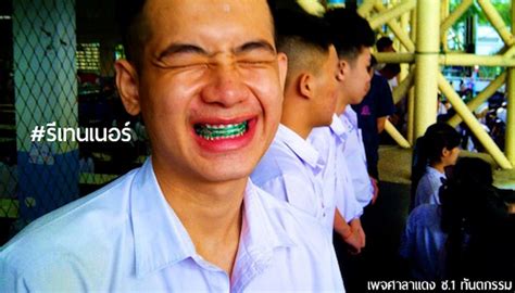 ต้องใส่รีเทนเนอร์ ก่อนจัดฟันไหม