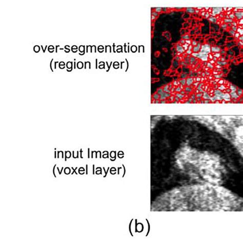 A The Hierarchical Interaction Structure Of An Image In Different Download Scientific Diagram