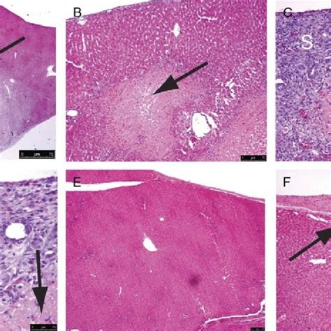 On Day 3 Posttransient Occlusion Of The Hepatic Vascular Inflow Download Scientific Diagram