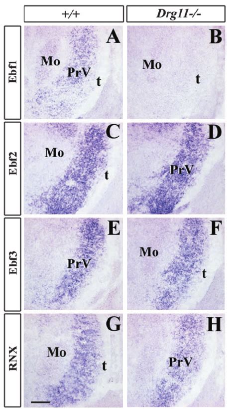Expression Of Molecular Markers In The Prv Detected By In Situ
