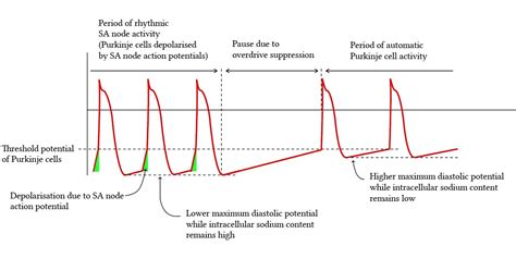 Pacemaker Action Potential