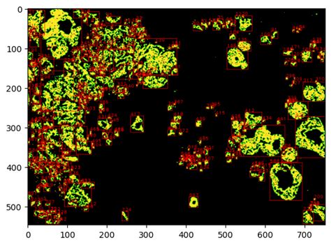Single Tme Analysis With Xenium Data — Skny 0212 Documentation