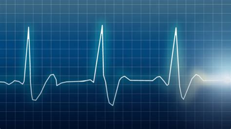 Ama Submission To Mrac Electrocardiogram Ecg Working Group Post Implementation Review Of