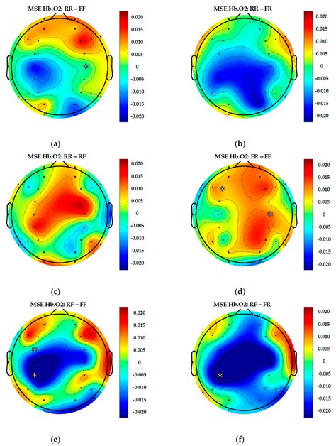 Multiscale Entropy As A New Feature For Eeg And Fnirs Analysis
