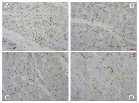Quantitative Analysis Of The Capillary Density In The Peri Infarct Area