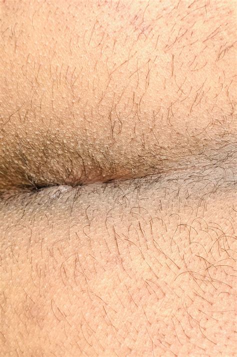 Close Up Asshole 9 Pics Xhamster