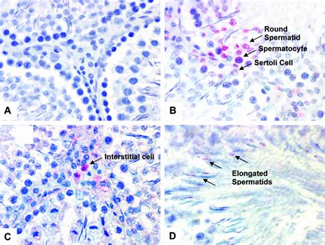 Localization Of Seoul Virus Nucleocapsid Protein In The Testes Of