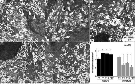 Temporal Transcriptome Analysis Reveals Dynamic Gene Expression Patterns Driving β Cell