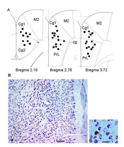 Location And Labeling Of Identified Anterior Cingulate Cortex Neurons Download Scientific