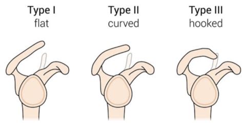Impingementbursitis Flashcards Quizlet