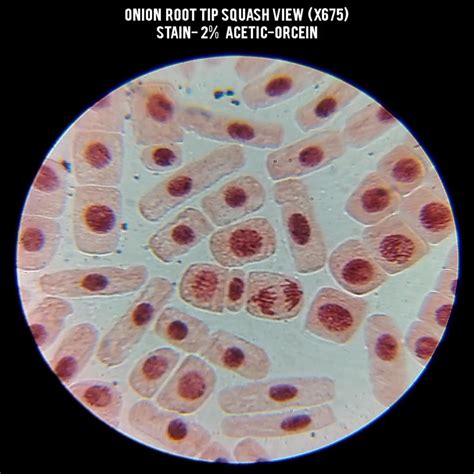 How To Use The Onion Cell Merged V Object Detection API