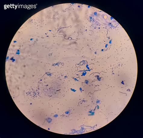 Streptococcus Pyogenes And Pneumonia Bacteria Micrograph 이미지