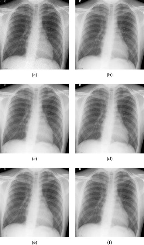 Figure 1 From Poissongaussian Noise Analysis And Estimation For Low