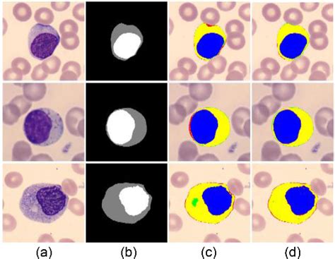 figure 1 from deep features aggregation based joint segmentation of