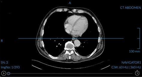 specific jpeg lossless dicom file produces gibberish pixel data · issue