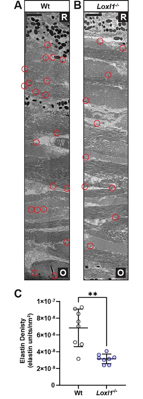 Elastic Fiber Reduction In The Pps Of Loxl1 ÀÀ Mice Representative