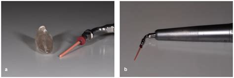 Applied Sciences Free Full Text Carrier Based Obturation Effect Of Sonication Technique On