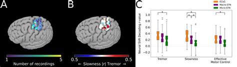 Cortical Tremor And Slowness Decoding Models Were Distributed Download Scientific Diagram