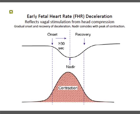 Fetal Monitoring N Flashcards Quizlet