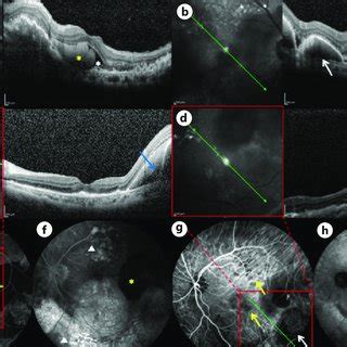 Multimodal Imaging Of The Patient At The Time Of Disease S Onset Download Scientific