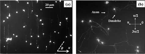 Figure 1 From Stochastic Models Of Neuronal Growth Semantic Scholar