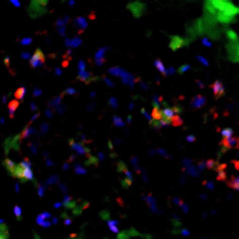 Spatial Multi Omics Omicsveu