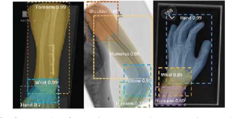 figure 1 from semantic segmentation of hands in multimodal images a