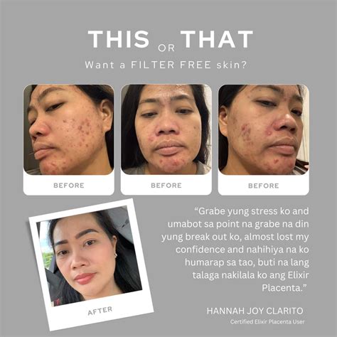 Client Testimonials 𝐄𝐥𝐢𝐱𝐢𝐫 Elixir Placenta Plus