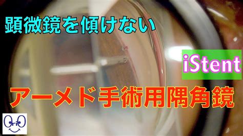 Ahmed Dvx Surgical Gonio For Istent Inject®︎ W Insertion Youtube