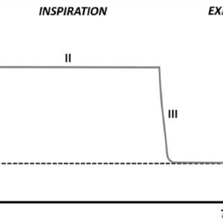 Flow Volume Curve Showing Intrathoracic Obstruction With Limited Download Scientific Diagram