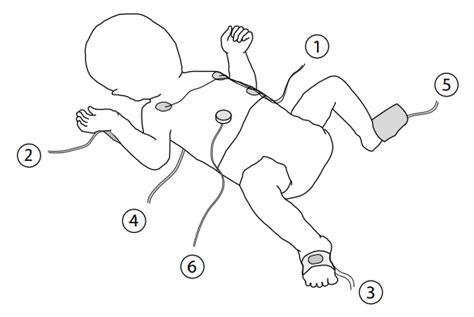 GitHub Jqug Neonatal Monitoring