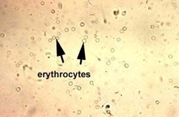 Urine Lab Practical Flashcards Quizlet