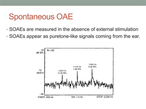 Oae And Bera Otoacoustic Emissions And Brainstem Evoked Response