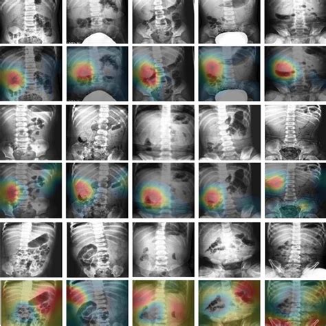 Class Activation Map Cam For Images Which Were True Positive In The