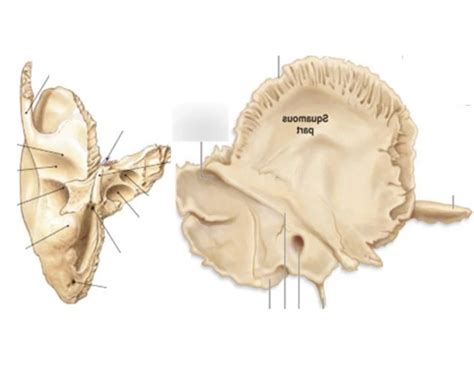 Temporal Inferior And Medial Quiz