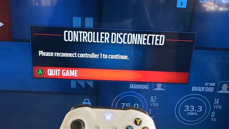 Xbox One Controller Disconnects From Xbox Fix Youtube