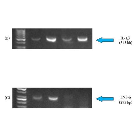 The Rt Pcr Analysis Of Mrna Expression For β Actin A Il 1β B