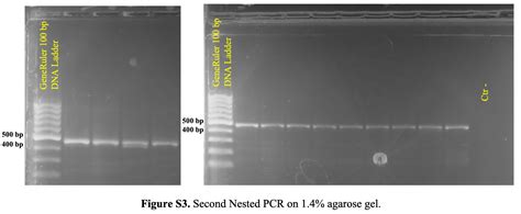Integration Of Codon Optimized Modified Sars Cov 2 Spike Mrna Into Human Dna