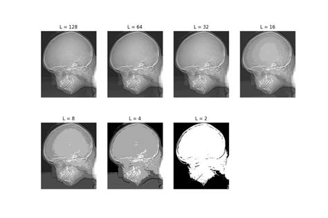 Imageprocessing Python Opencv Computervision Machinelearning Ai Ali Rasouli