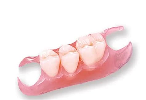 Flipper Partial Denture Direct Dental Prosthetics
