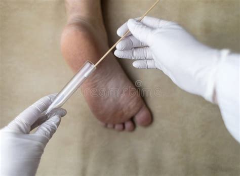 Dermatologist Using A Cotton Swab And Test Tube To Take A Swab Sample