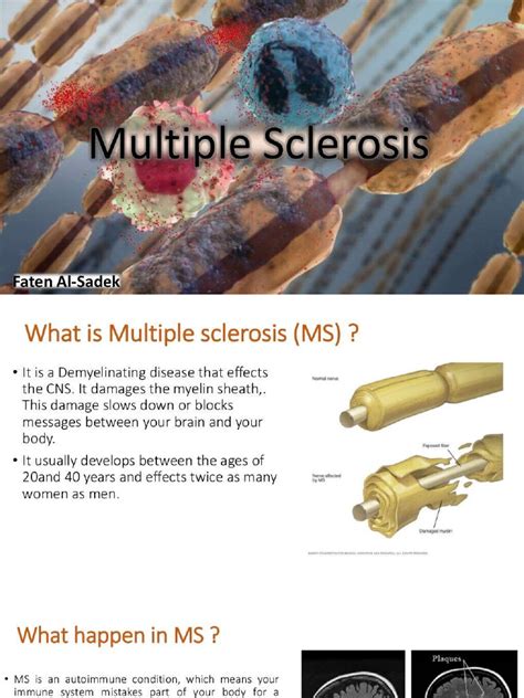 Multiple Sclerosis Pathophysiology Diagnosis And Treatment Pdf