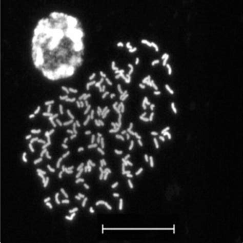 Chromosome Count Analysis On Metaphase Spreads Of One G Kola Download Scientific Diagram